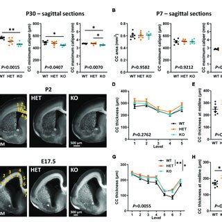 Corpus Callosum CC Morphology In Adult Mice Representative Images Of Download Scientific
