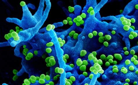 Lassa Fever Vaccine Enters Phase 1 Clinical Trial Healthcare Hygiene