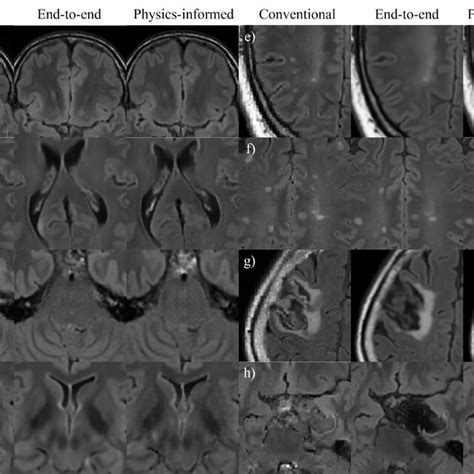 Quantitative Comparison Of The End To End And Physics Informed Download Scientific Diagram
