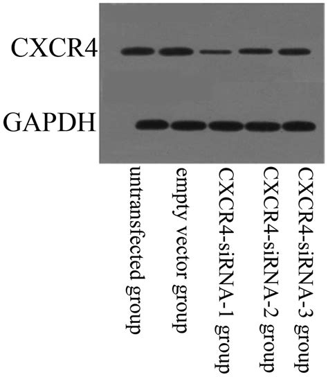 Effect Of Cxcl12 Cxcr4 On Increasing The Metastatic Potential Of Non‑small Cell Lung Cancer In