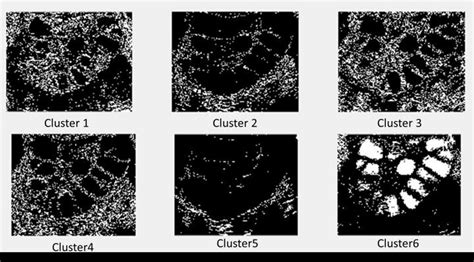 Six Clusters Of Ovarian Ultrasound Image With K Means Clustering