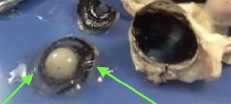 Lab 11 Lab 9 Lab 10 Flashcards Quizlet