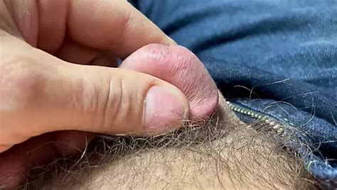 Micro Cock Tiny Penis Pictures 23 Nude Pics Xhamster