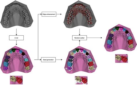 Proposed Approach By Teethseg Team The Mesh Is Segmented Using The Download Scientific Diagram