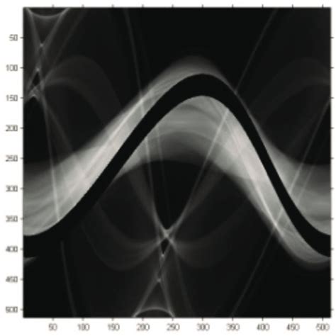 Result Of Applying Hough Transform Algorithm For S Like Curve Detection Download Scientific