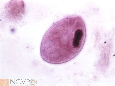 Balantidium Coli Cyst And Trophozoite
