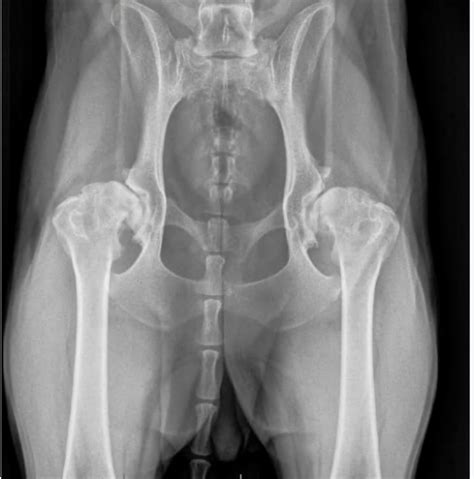 Hip Dysplasia And The Hip Health Project The Hip Health Project