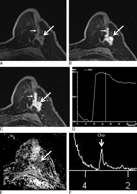 Improved Diagnostic Accuracy With Multiparametric Magnetic R Investigative Radiology