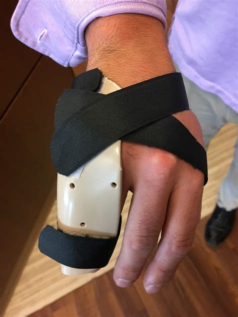 Hand Therapy Splinting Tips On Tumblr