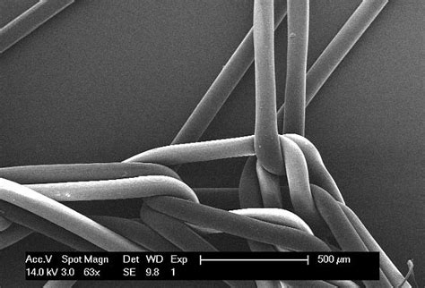 Campaigners Slam Material That Could Replace Vaginal Mesh Daily Mail Online