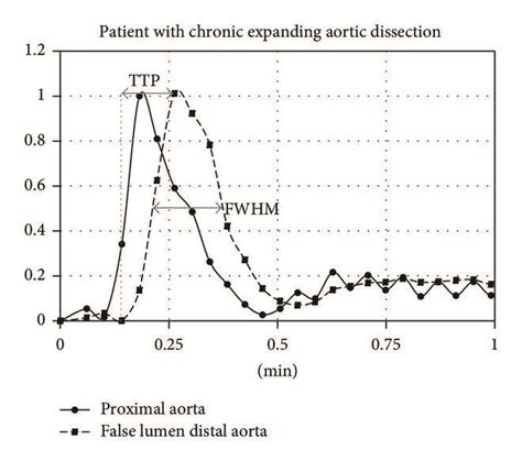 Time Intensity Curves As Measured By Time Resolved Mra In Download