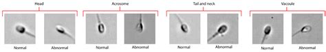 Mathematics Free Full Text Sperm Abnormality Detection Using Sequential Deep Neural Network