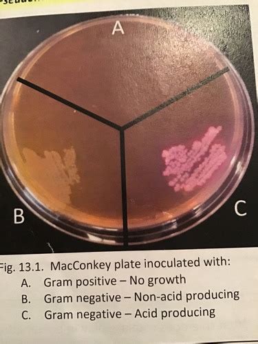 Bio 230 Lab Practical 2 Flashcards Quizlet