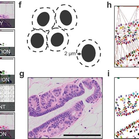 nuclei segmentation performance examples of nuclei segmentation with