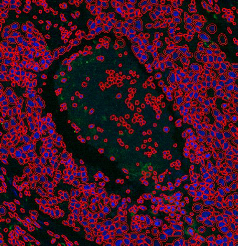How To Remove The Hole In Qupath To Exculde In Segmentation Image