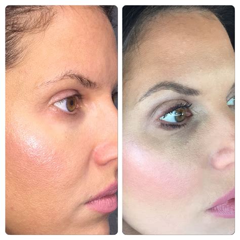 Before And After 2 Weeks Post Microblading Procedure Mollielewismicroblading Microblading