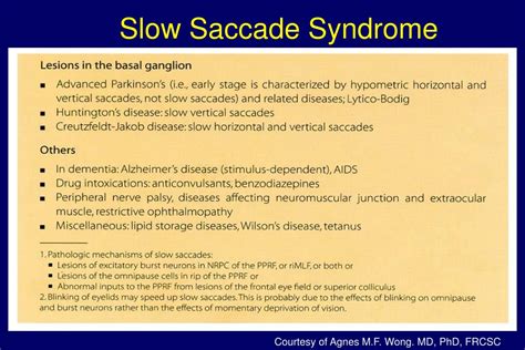 Ppt Saccades And Saccadic Oscillations Powerpoint Presentation Free Download Id 938206