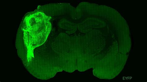 Mit Tech Review 人間の神経細胞をラットに移植、脳の6分の1にまで成長