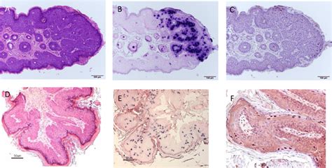 A Haired Skin Lip Lesion From A Nude Mouse Hande Staining Shows
