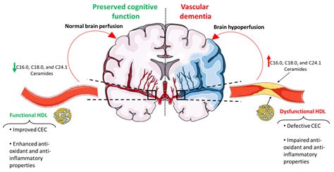 Lecithin Brain Effects At Xavier Brill Blog