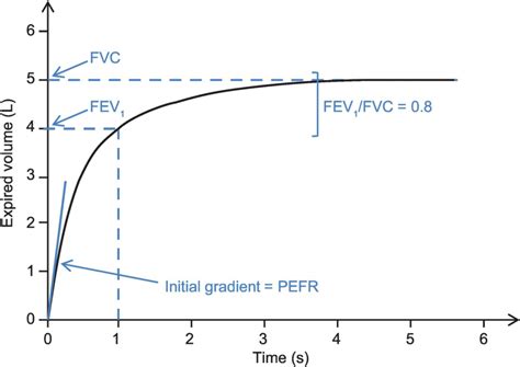 Chapter 13 Spirometry Anesthesia Key