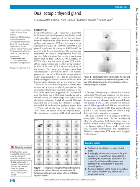 Pdf Dual Ectopic Thyroid Gland