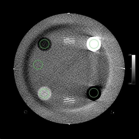 Pdf Using The Acr Ct Accreditation Phantom For Routine Image Quality Assurance On Both Ct And