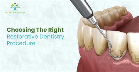 Choosing The Right Restorative Dentistry Procedure Palm Tree Dental