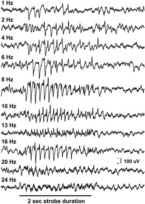 Character Of The Sensitized Response Varies With Temporal Frequency Of