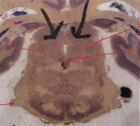 Serotonergic Neurons Diagram Quizlet