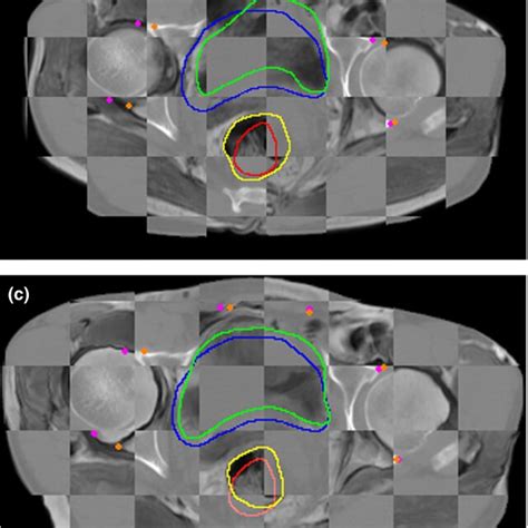 The Structure Of The Fully Convolutional Network Fcn Moving Image Download Scientific