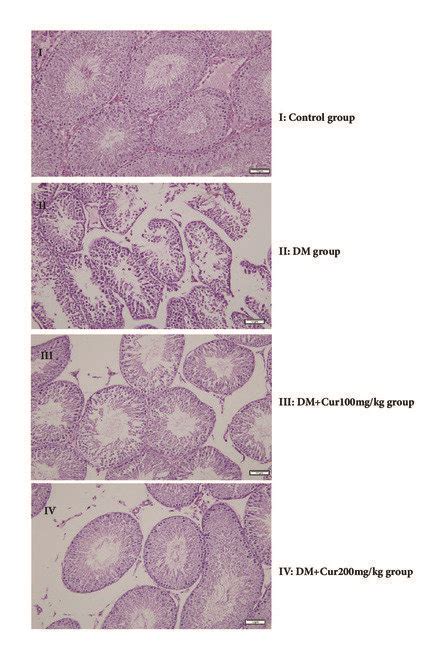 Histological Changes In Testes Visualized Using Hematoxylin Eosin Download Scientific Diagram