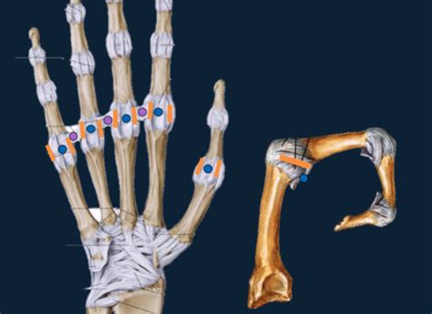 Metacarpophalangeal Mcp Joint Flashcards Quizlet