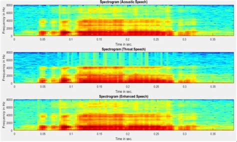 Speech Spectrogram Comparison Between The Acoustic Speech Throat