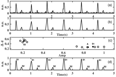 Heart Sounds Segmentation And Classification Without Artifacts A Download Scientific Diagram