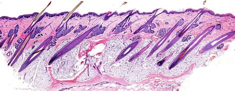 Human Scalp Under Microscope Labeled