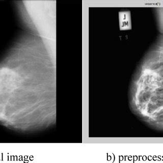 Applying Sequence 2 Of Preprocessing Techniques Download Scientific Diagram