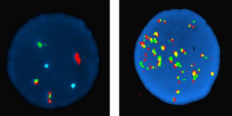 Myc Myc Proto Oncogene Bhlh Transcription Factor