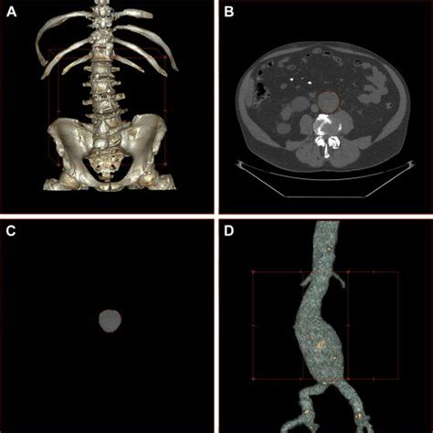 A Three Dimensional 3d Volume Rendering Of The Bone Structures Download Scientific Diagram