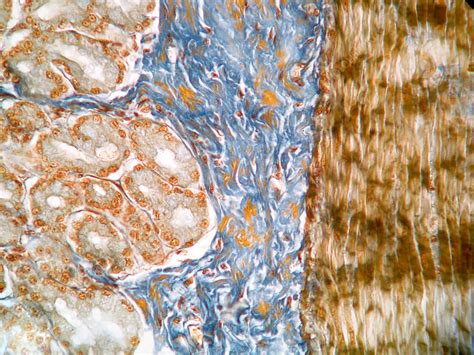Duodenum Cat Dissection
