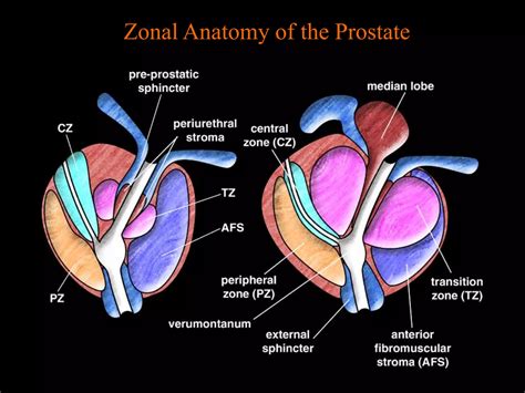 Prostate Mri Anatomy From University Of Michigan Pptx