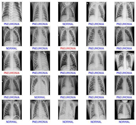 Creating A Chatbot Using Nltk And Deep Learning By Alifia Tanza Medium