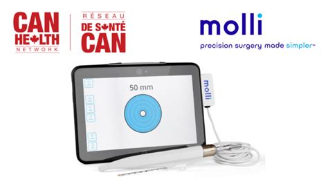Molli Surgical Joins Forces With Can Health Network To Scale Its Cutting Edge Breast Cancer