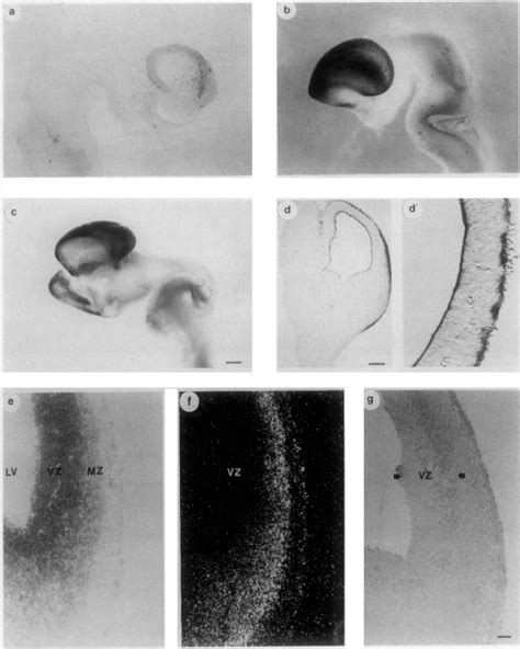 Allocortex Semantic Scholar