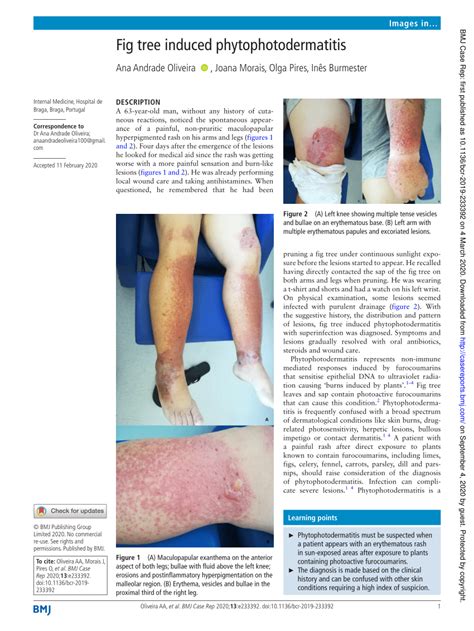 Pdf Fig Tree Induced Phytophotodermatitis