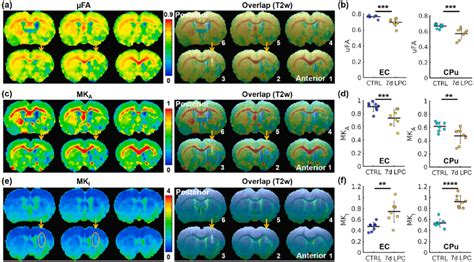 Tensor Valued Diffusion Mri Metrics Of Wm Ec And Dgm Cpu Lesions A Download Scientific