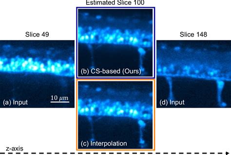 Low Dosage 3d Volume Fluorescence Microscopy Imaging Using Compressive Sensing