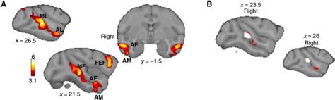 Face Responsive Areas In Macaques A Macaque Group Contrast Of Face