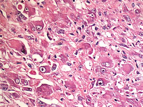 Soft Tissue Clinical Tree