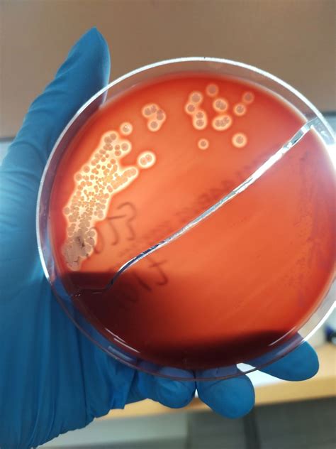 Nikolic Marija On Linkedin Staphylococcus Aureus β Hemolysis